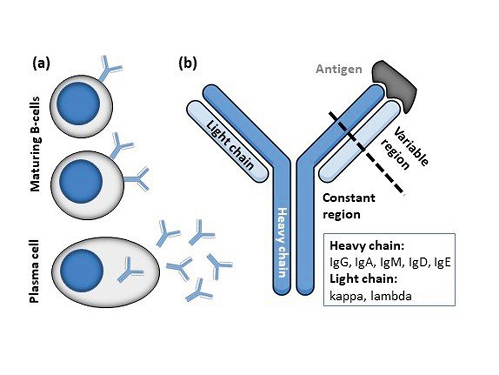 Biochemical Investigation Of Monoclonal Gammopathies Clinical Biochemical Investigation Of Monoclonal Gammopathies Clinical