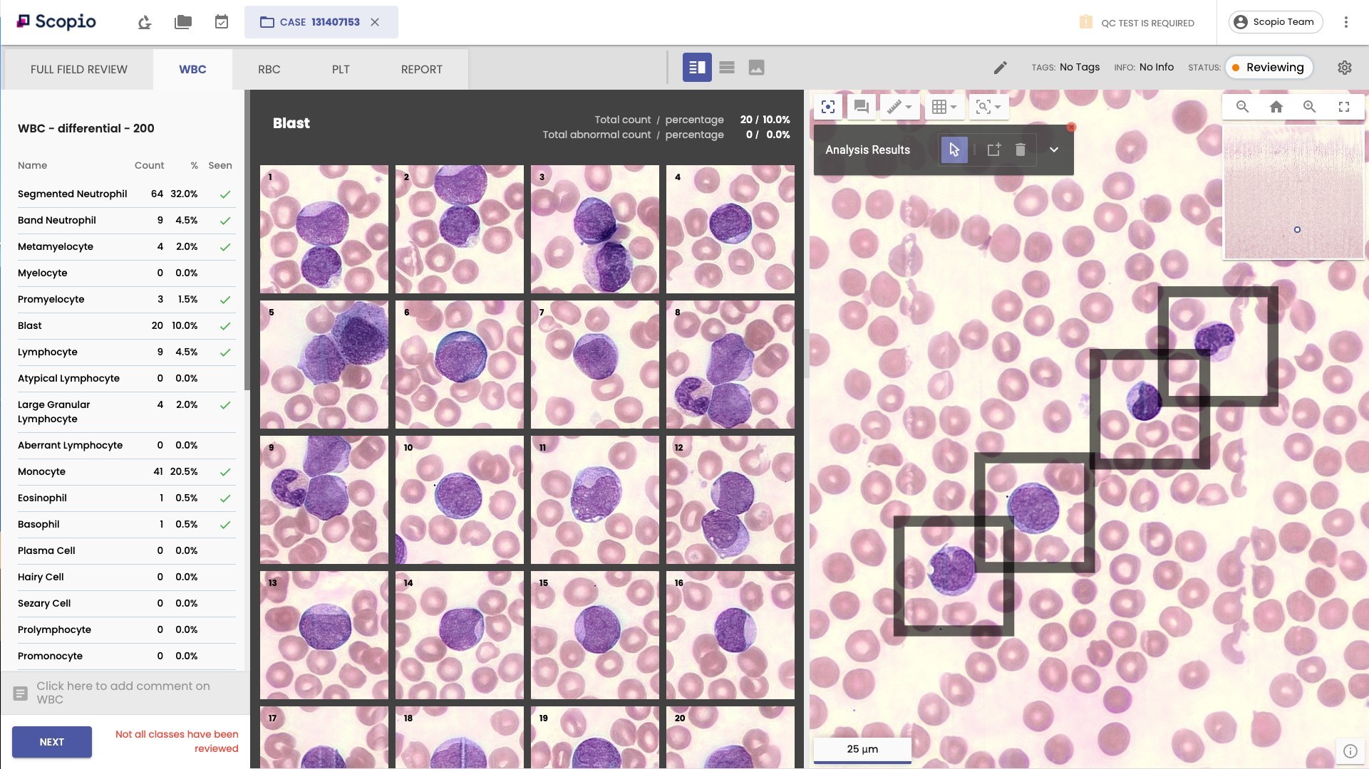 Scopio Labs launches full-field peripheral blood smear application - Clinical Laboratory int.