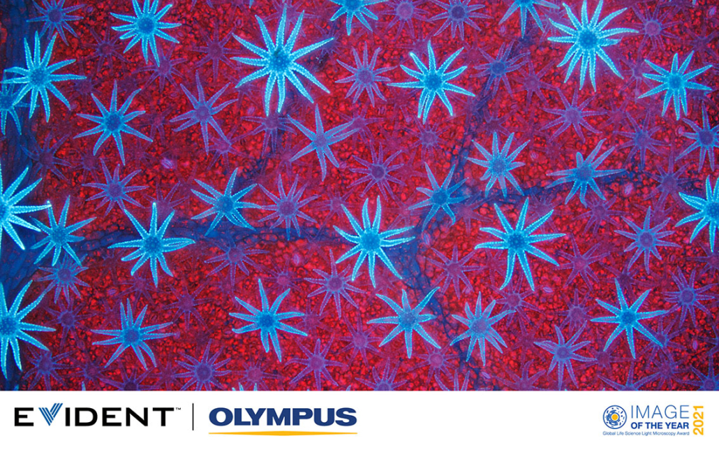 The Art of Science: EVIDENT launches expanded Global Image of the Year ...