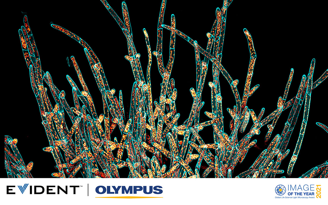 The Art of Science: EVIDENT launches expanded Global Image of the Year ...