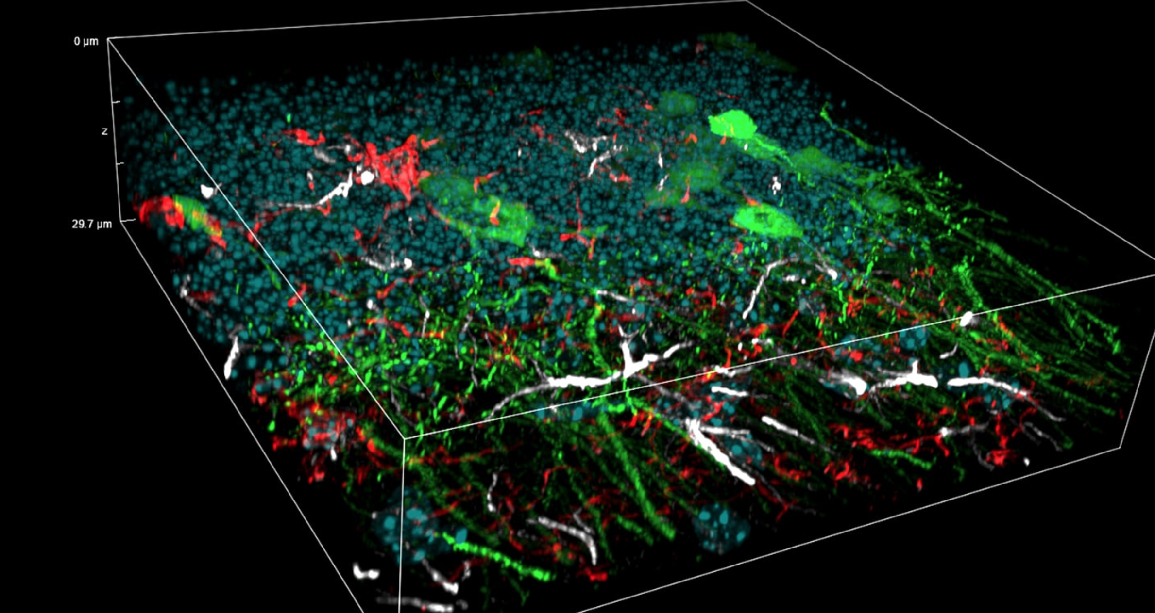 CrestOptics’ DeepSIM super resolution confocal microscope module wins ...