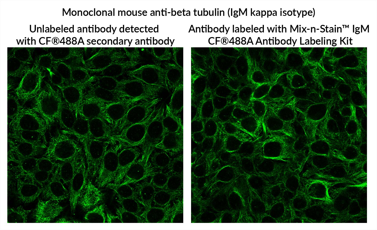 Biotium introduces novel antibody labelling kits for rapid labelling of ...
