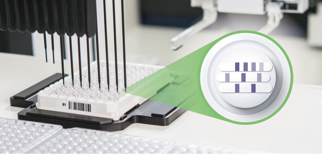 Immunoblots – an old friend with a new face - Clinical Laboratory int.