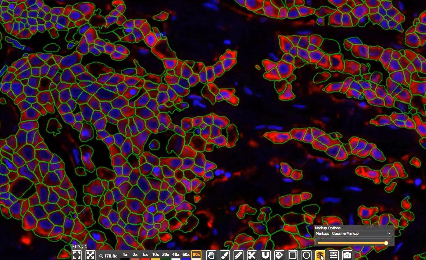 Indica Labs releases AI-powered digital pathology software update - Clinical Laboratory int.