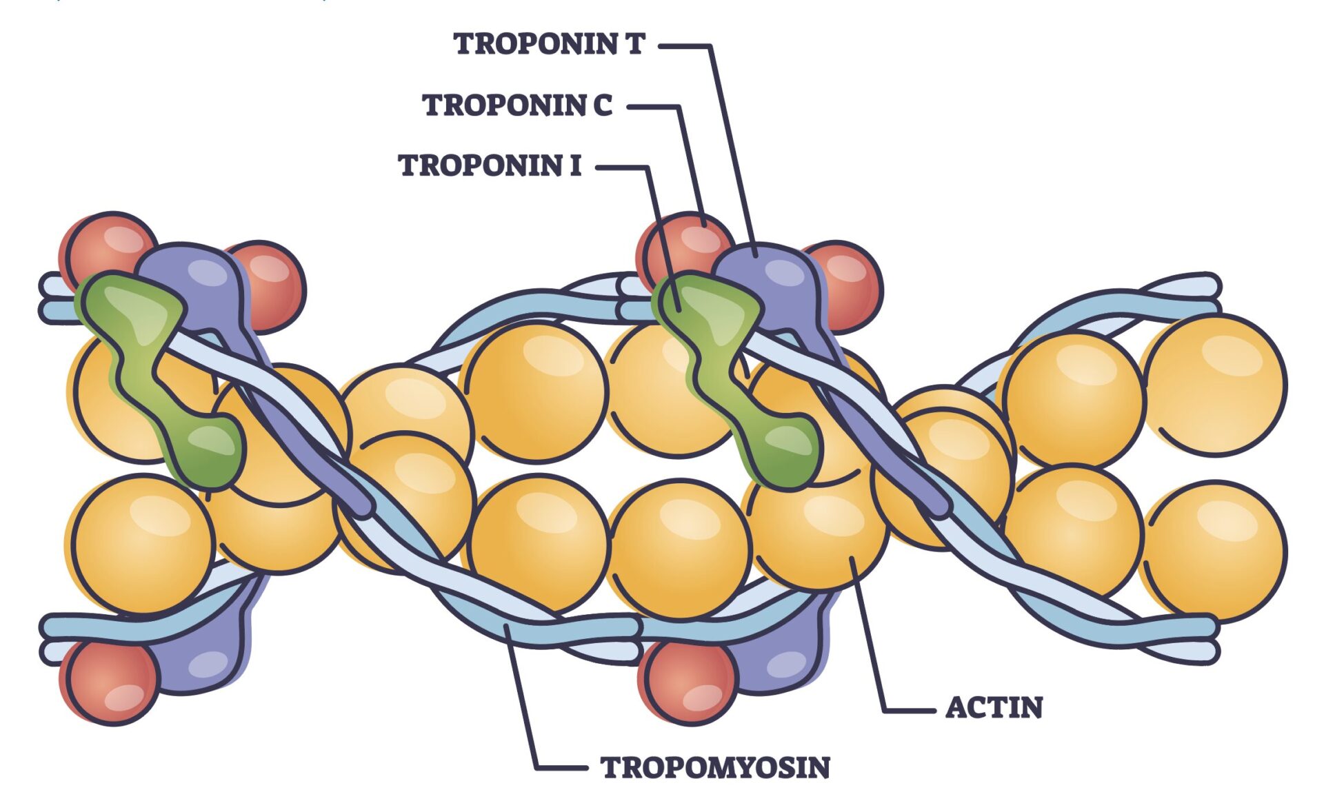 Macrotroponin: potential source of cardiac troponin assay interference ...