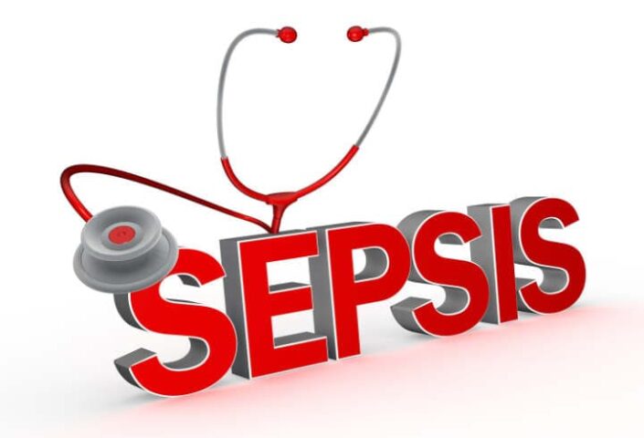 IL-6 biomarker breakthrough for early sepsis detection